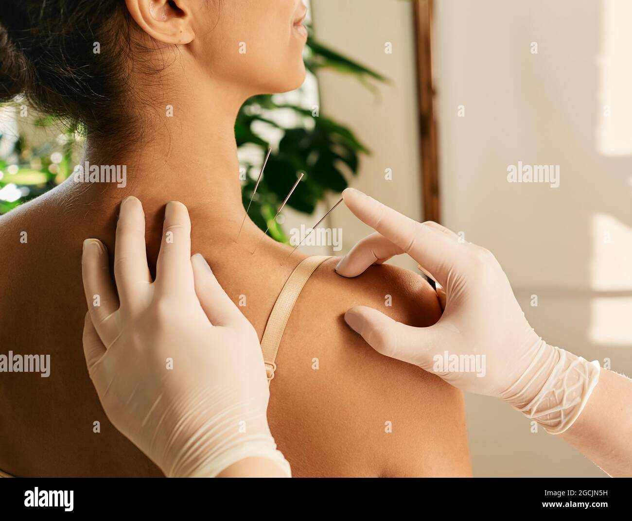 Reflexologist hand with acupuncture needle close-up during insert ...