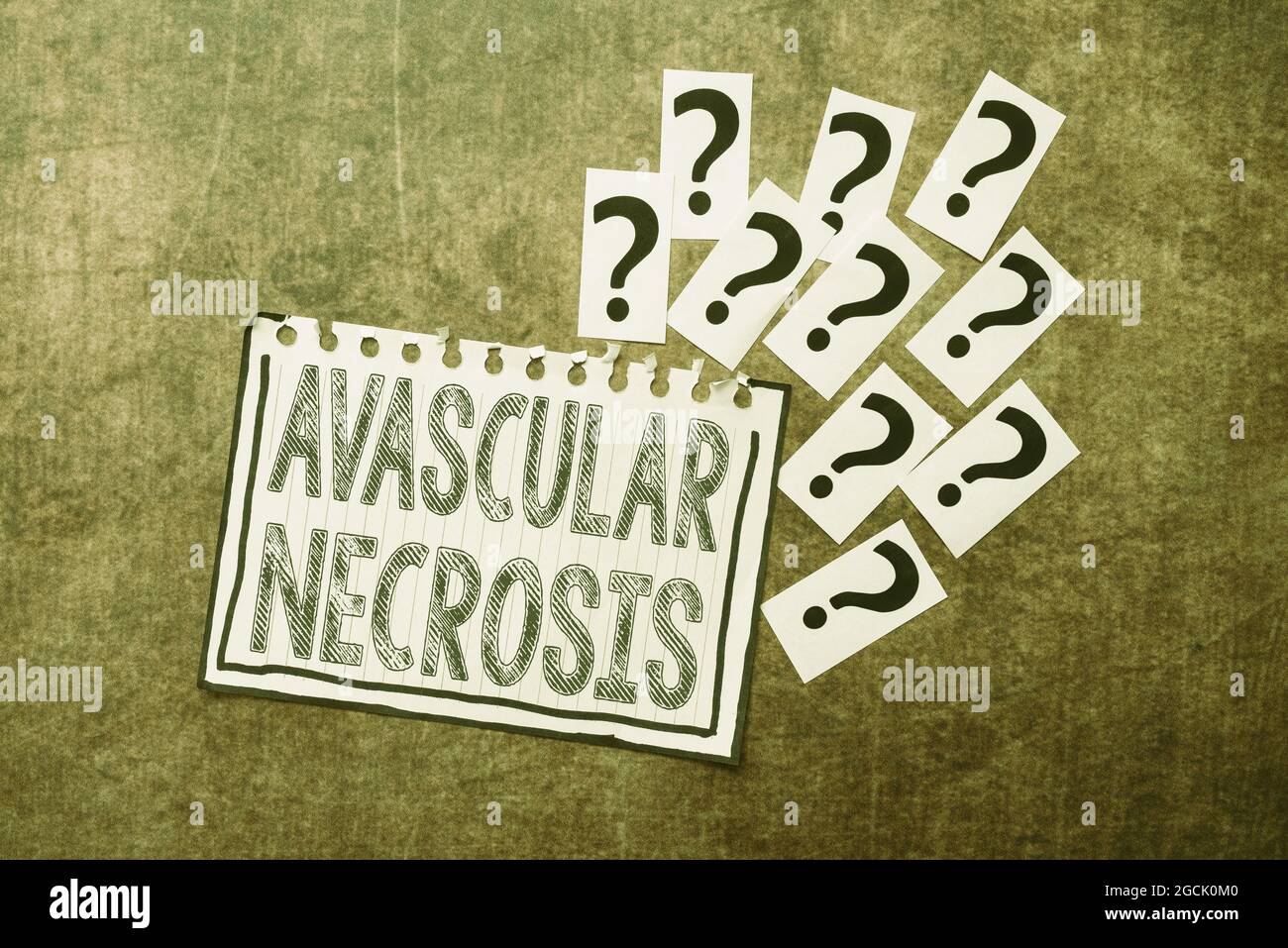 Conceptual caption Avascular Necrosis. Word Written on death of bone ...