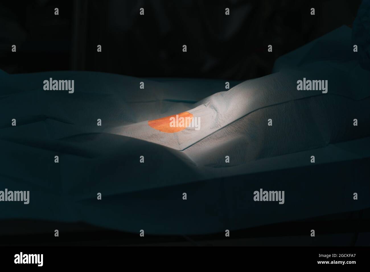 Selective focus of white sterile surgical hole drape covering paw of ...