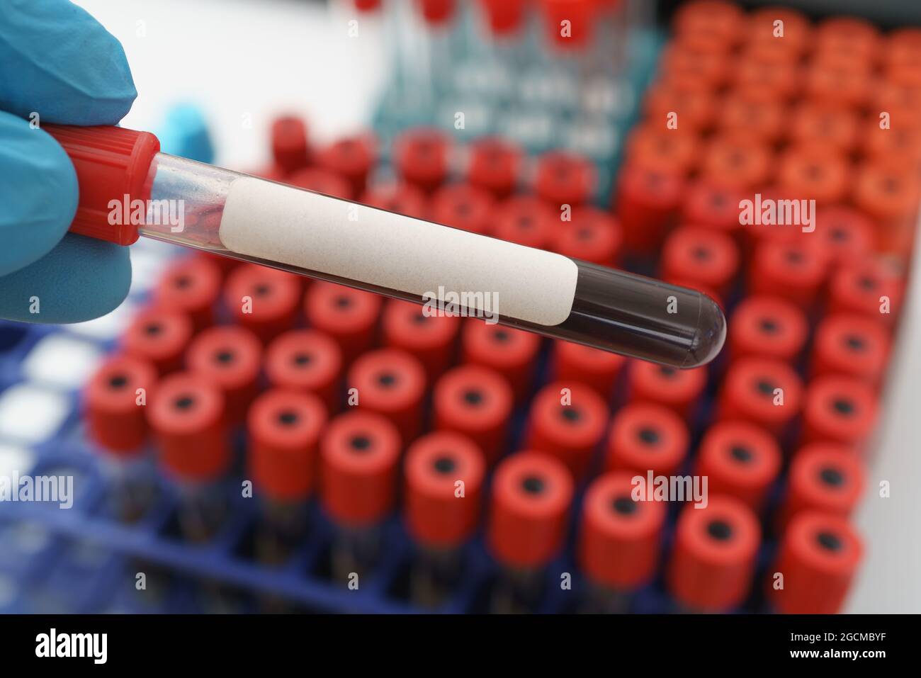 A test tube with a blood sample with empty label in the doctor's hand ...
