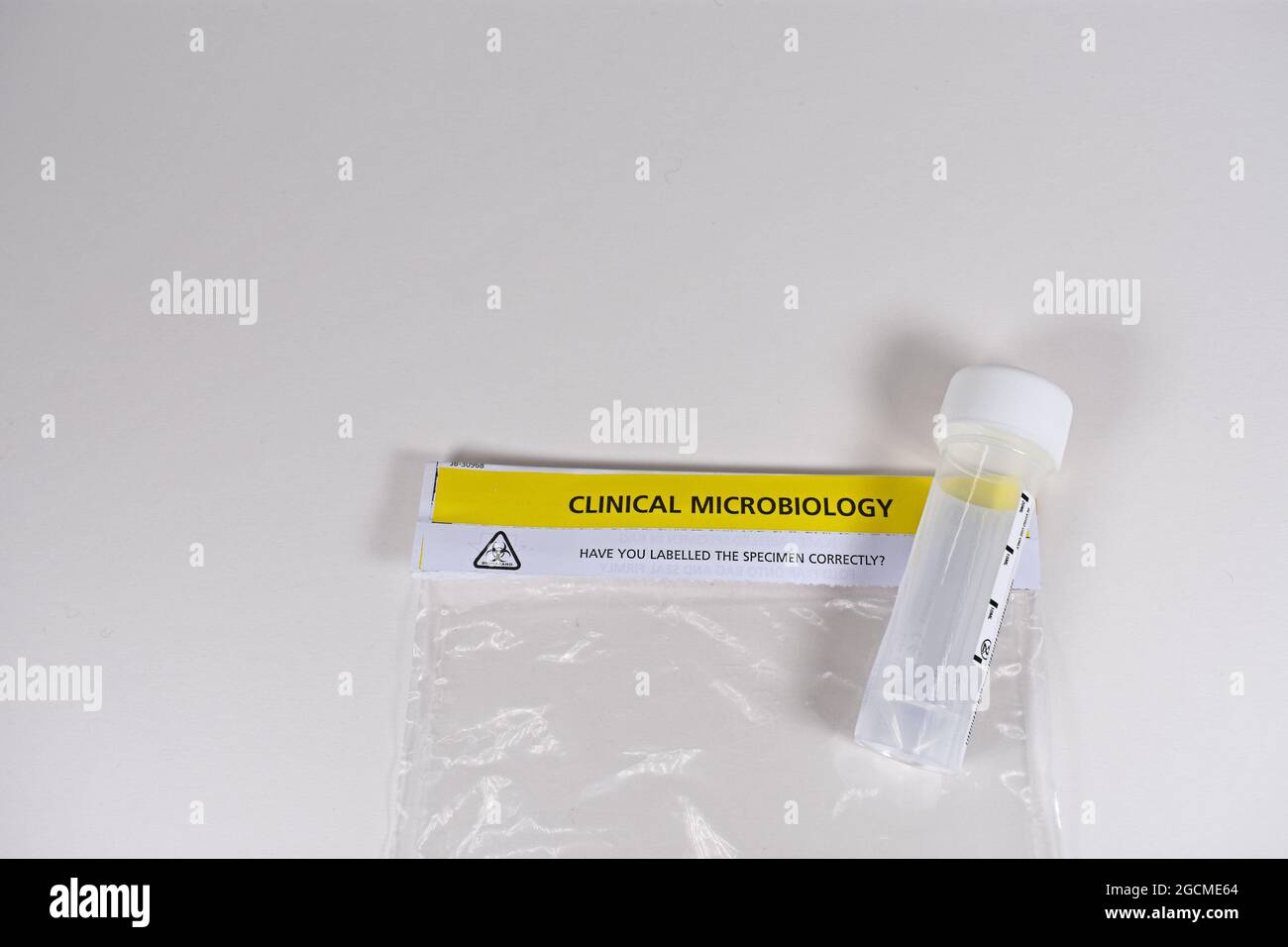 Clinical Microbiology specimen plastic bag with sample test container ...