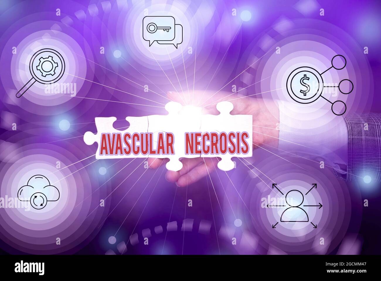 Text showing inspiration Avascular Necrosis. Conceptual photo death of ...