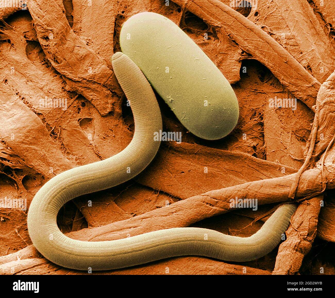 Micrograph of soybean cyst nematode hi-res stock photography and images ...