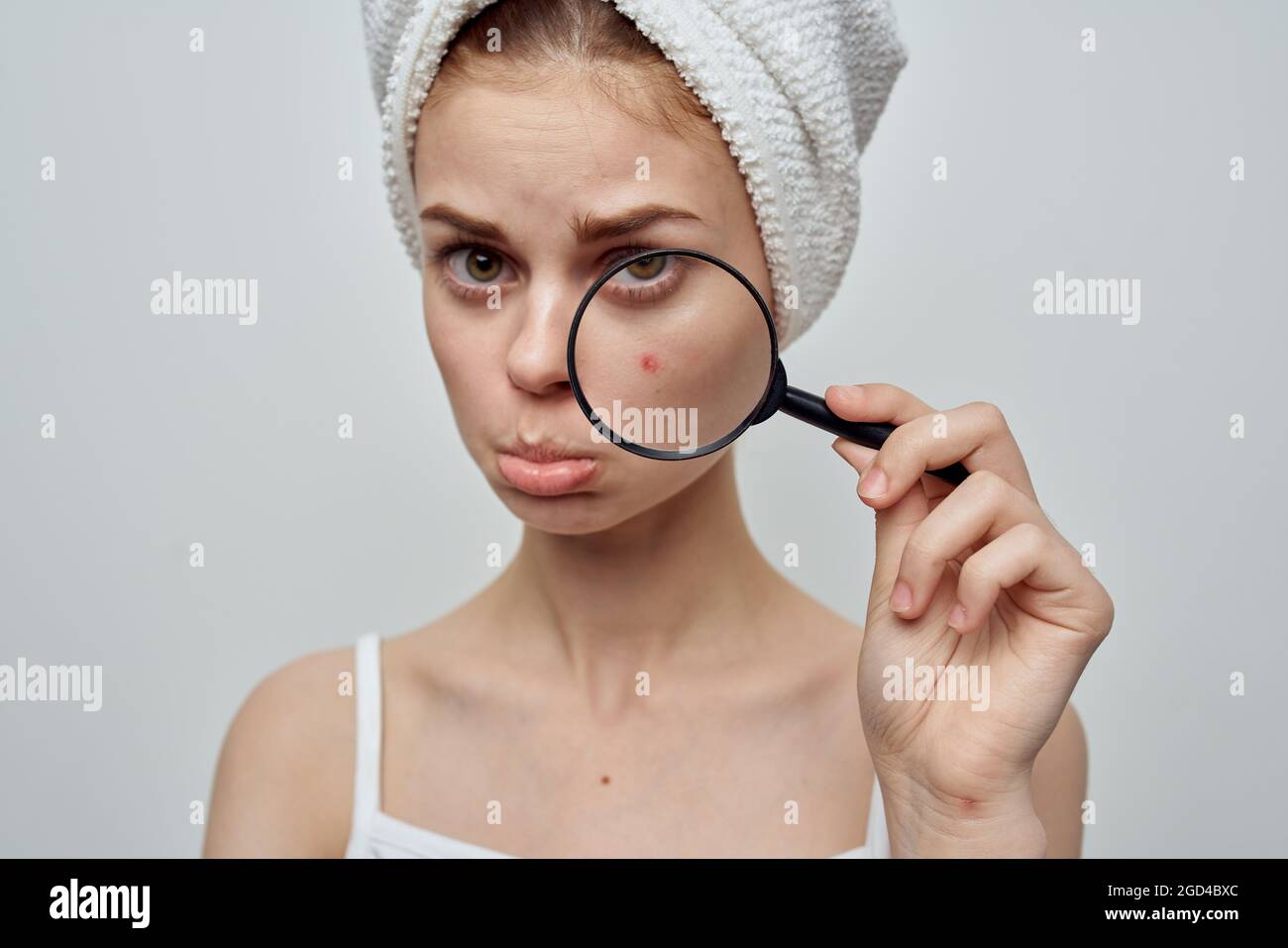beautiful woman with a pimple on the face skin problems close-up Stock ...