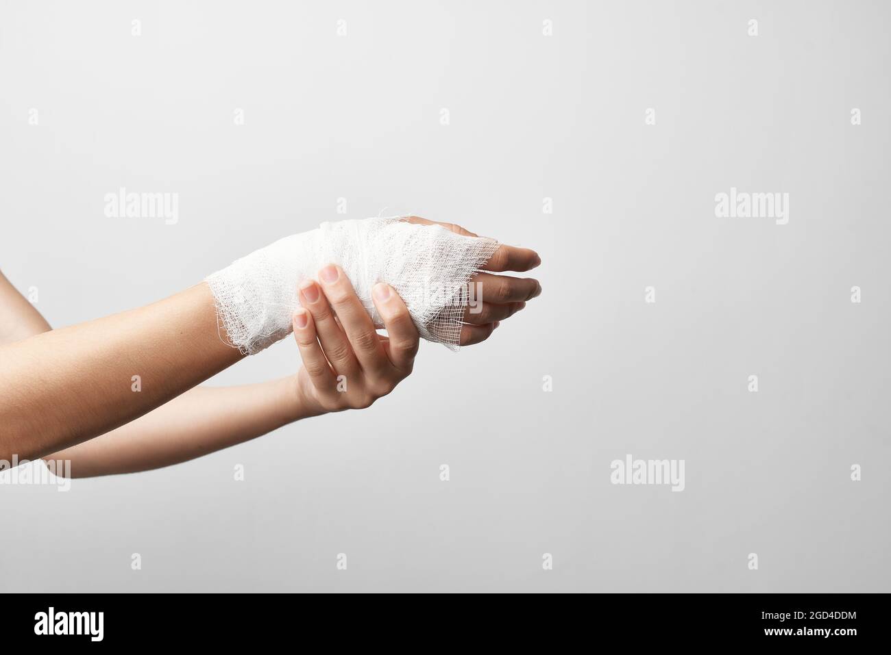 bandaged arm injury fracture health problems treatment Stock Photo - Alamy