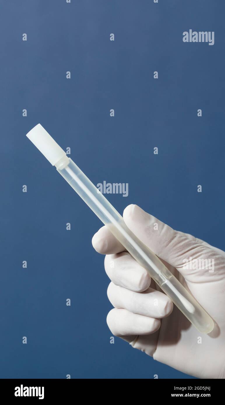 buccal swab with transport medium in the hands of a doctor or nurse ...