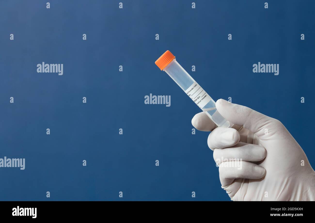 transport vial for laboratory, with red cap and sticker personal data ...