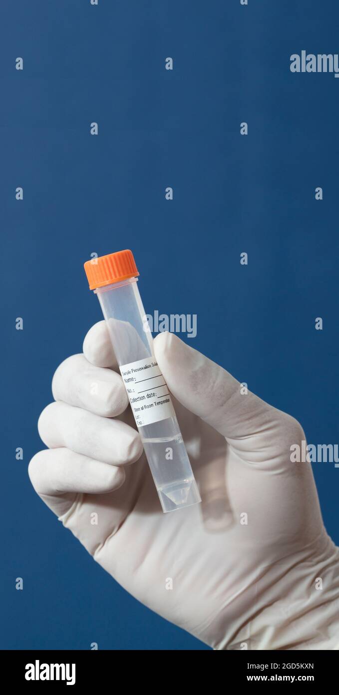 transport vial for laboratory, with red cap and sticker personal data ...