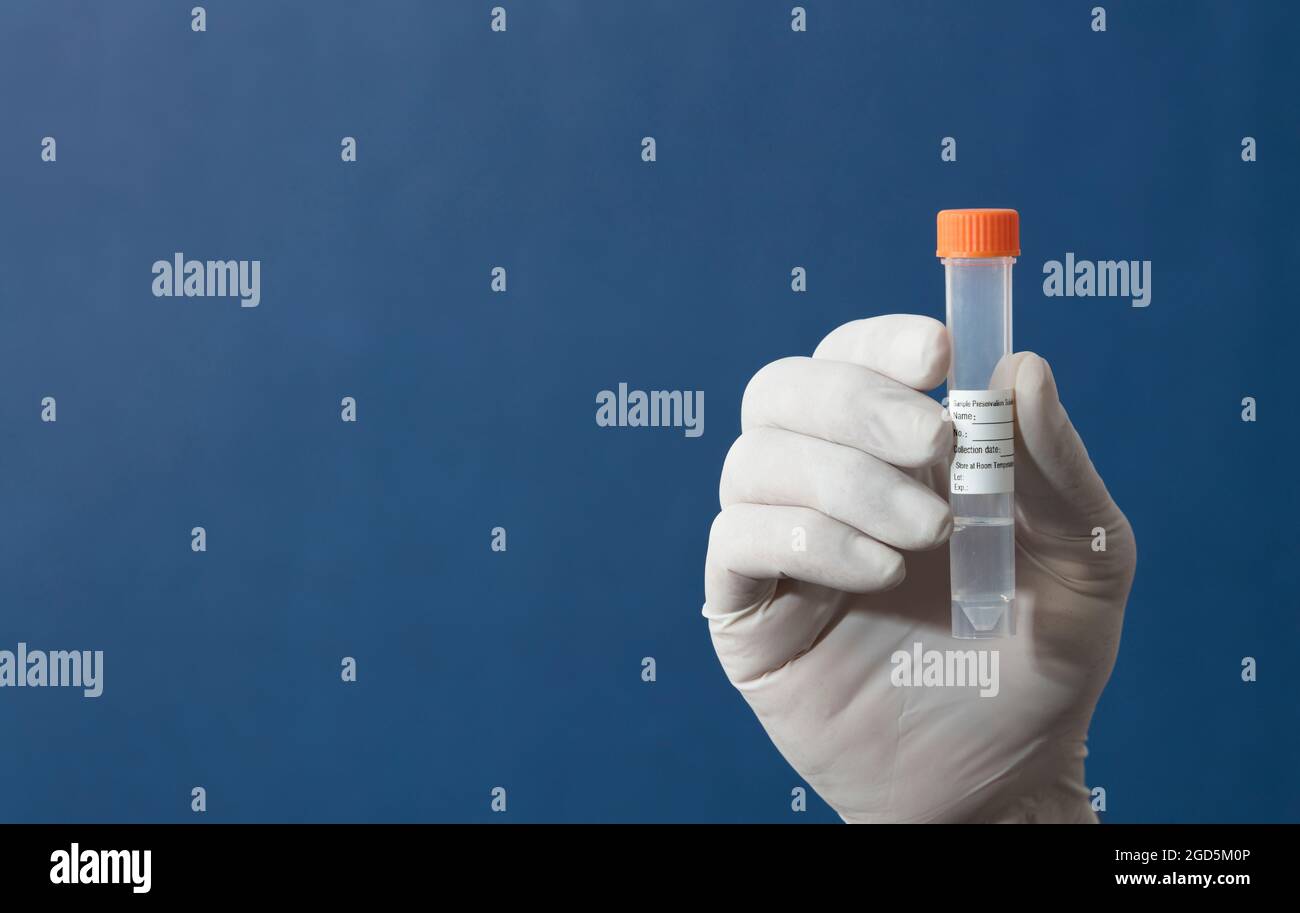 transport vial for laboratory, with red cap and sticker personal data ...