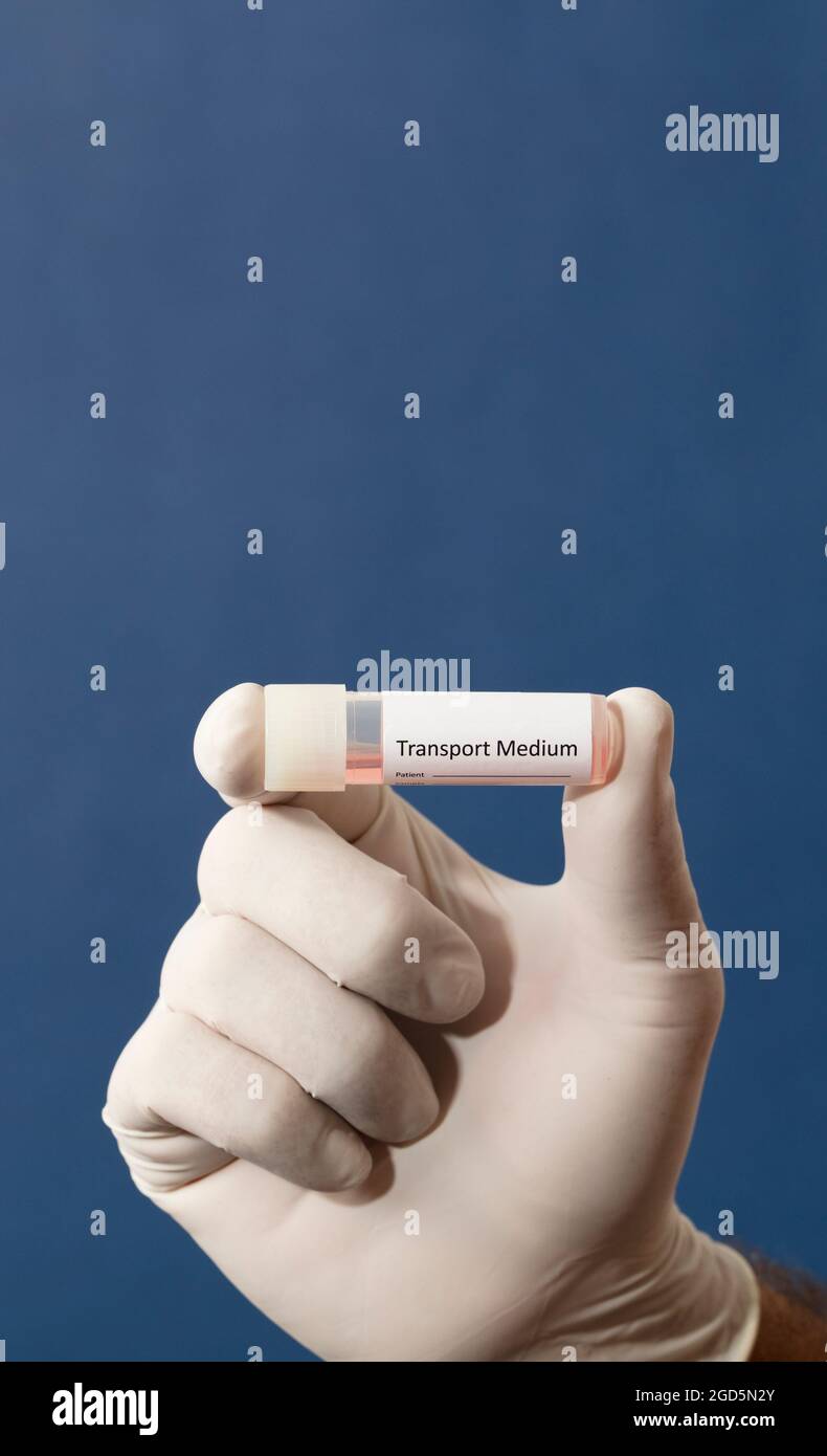 transport vial for pcr test, in the hands of a doctor, nurse ...