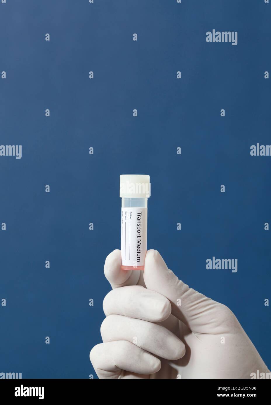 transport vial for pcr test, in the hands of a doctor, nurse ...