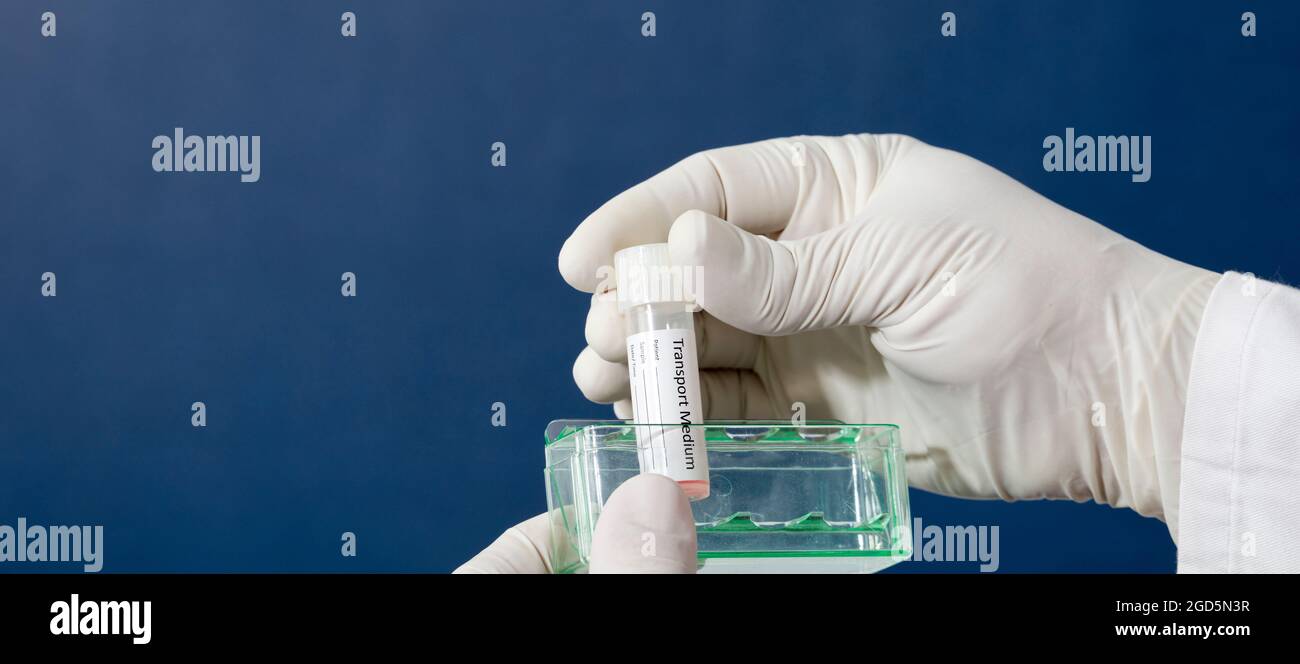 transport vial for pcr test, in the hands of a doctor, nurse ...