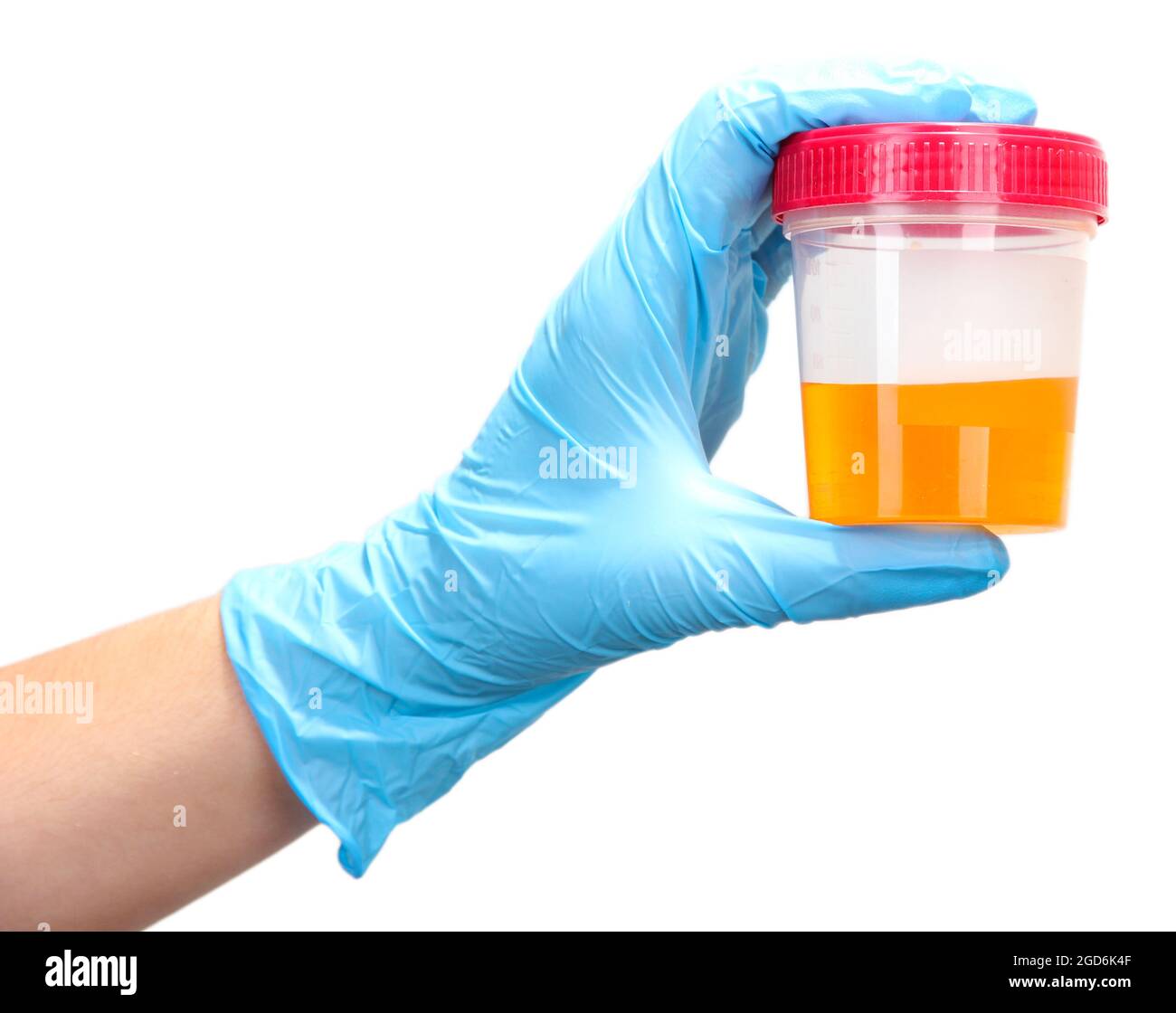 Medical urine test, close-up Stock Photo - Alamy