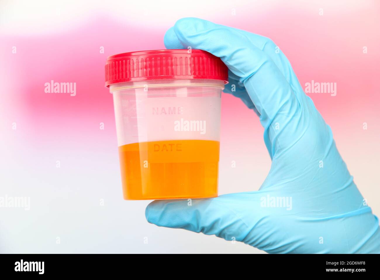 Medical urine test, close-up Stock Photo - Alamy