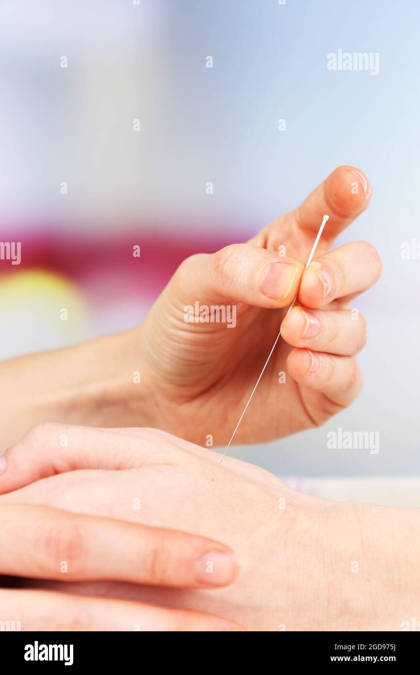 Acupuncture on hand, close up. Isolated on white Stock Photo - Alamy