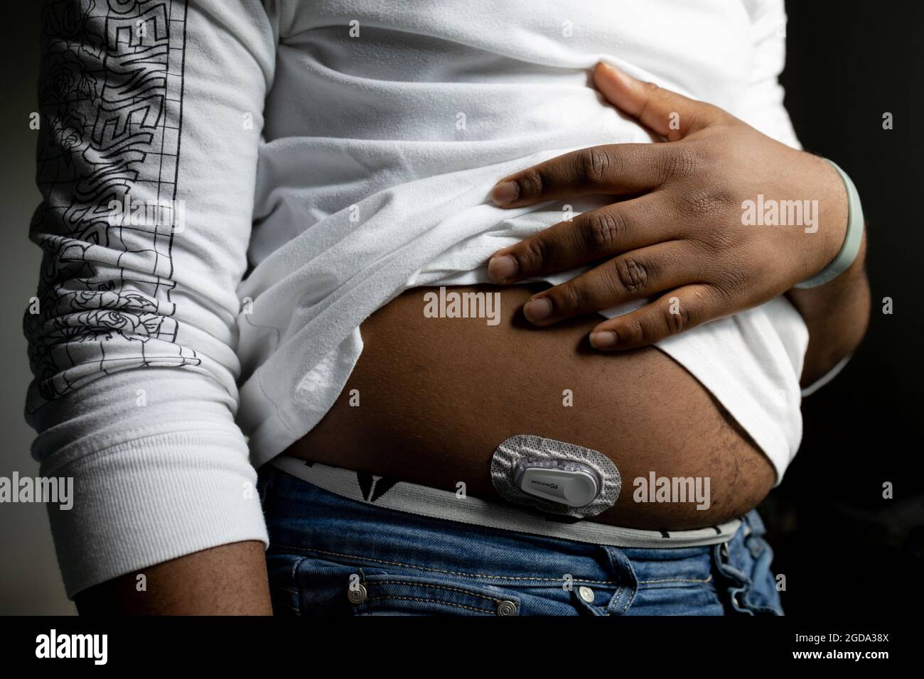 Dexcom sensor hi-res stock photography and images - Alamy