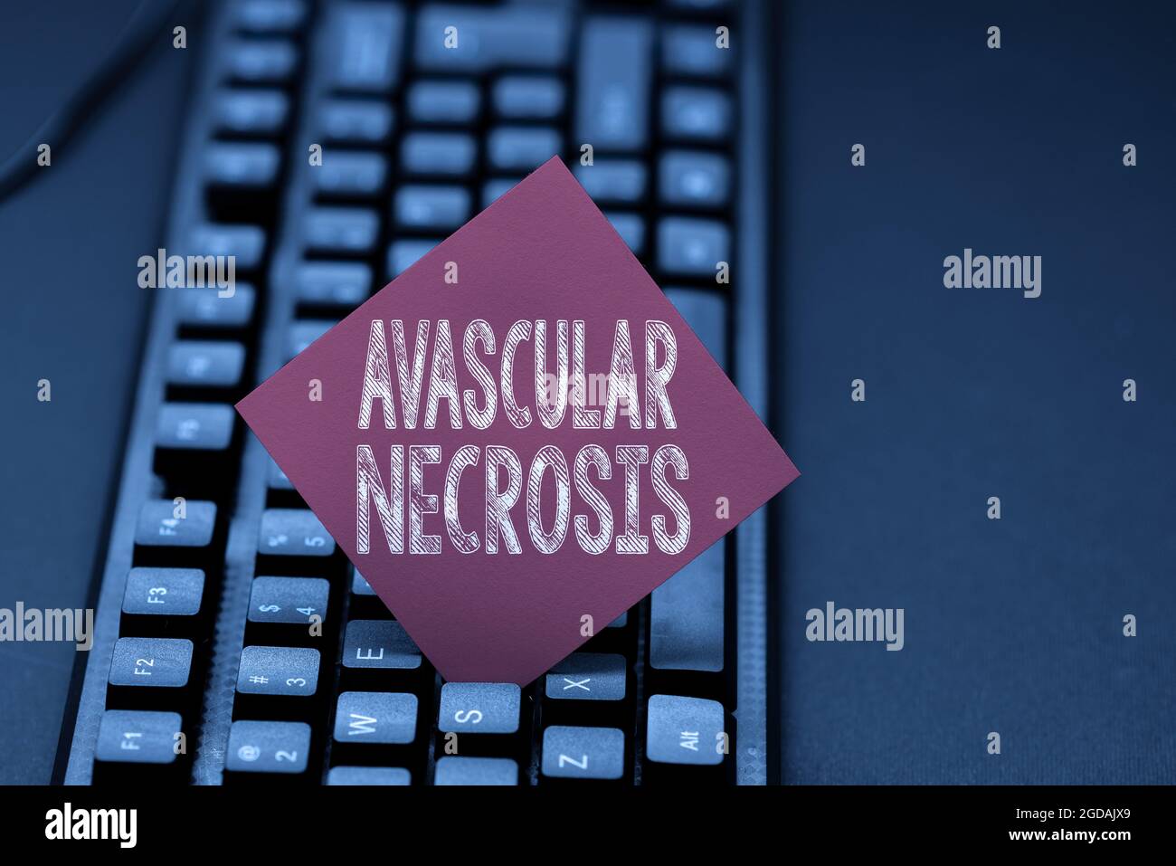 Text showing inspiration Avascular Necrosis. Conceptual photo death of ...