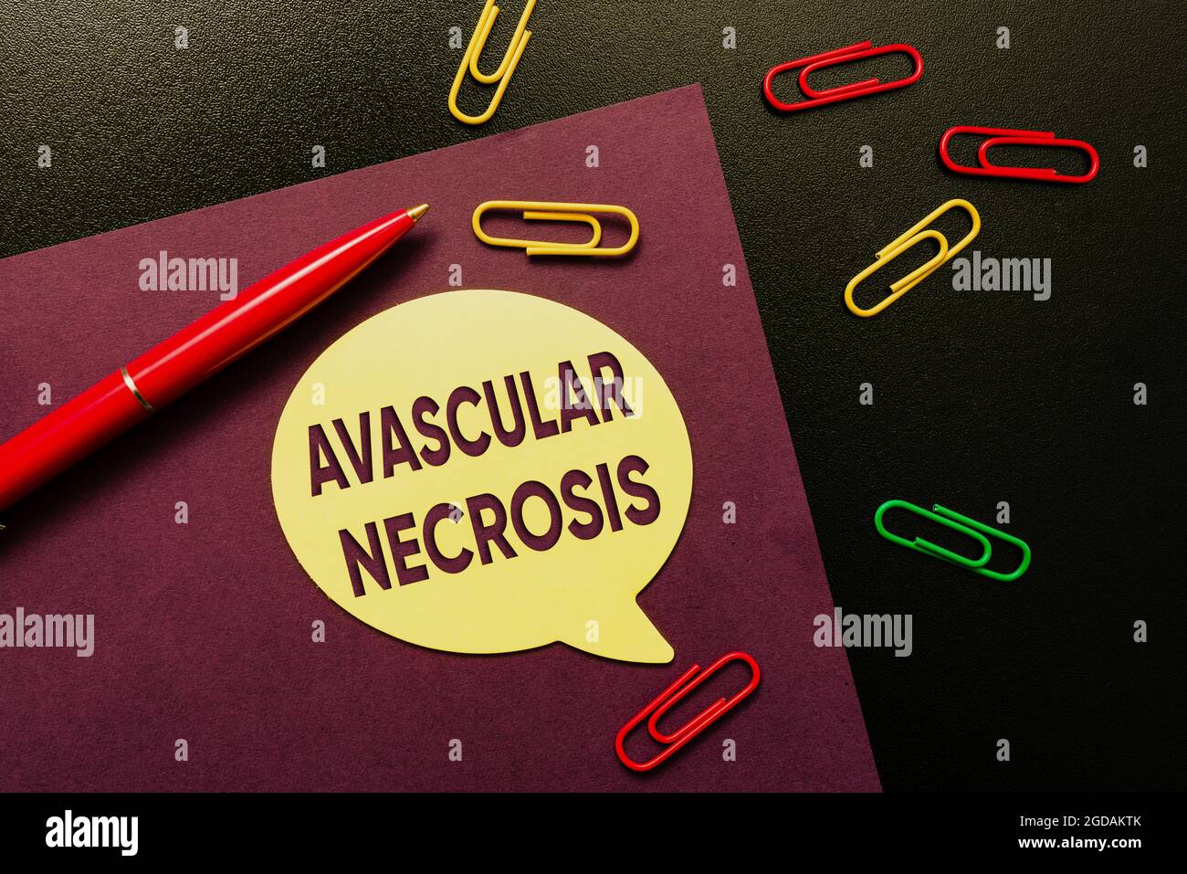 Text sign showing Avascular Necrosis. Business idea death of bone ...