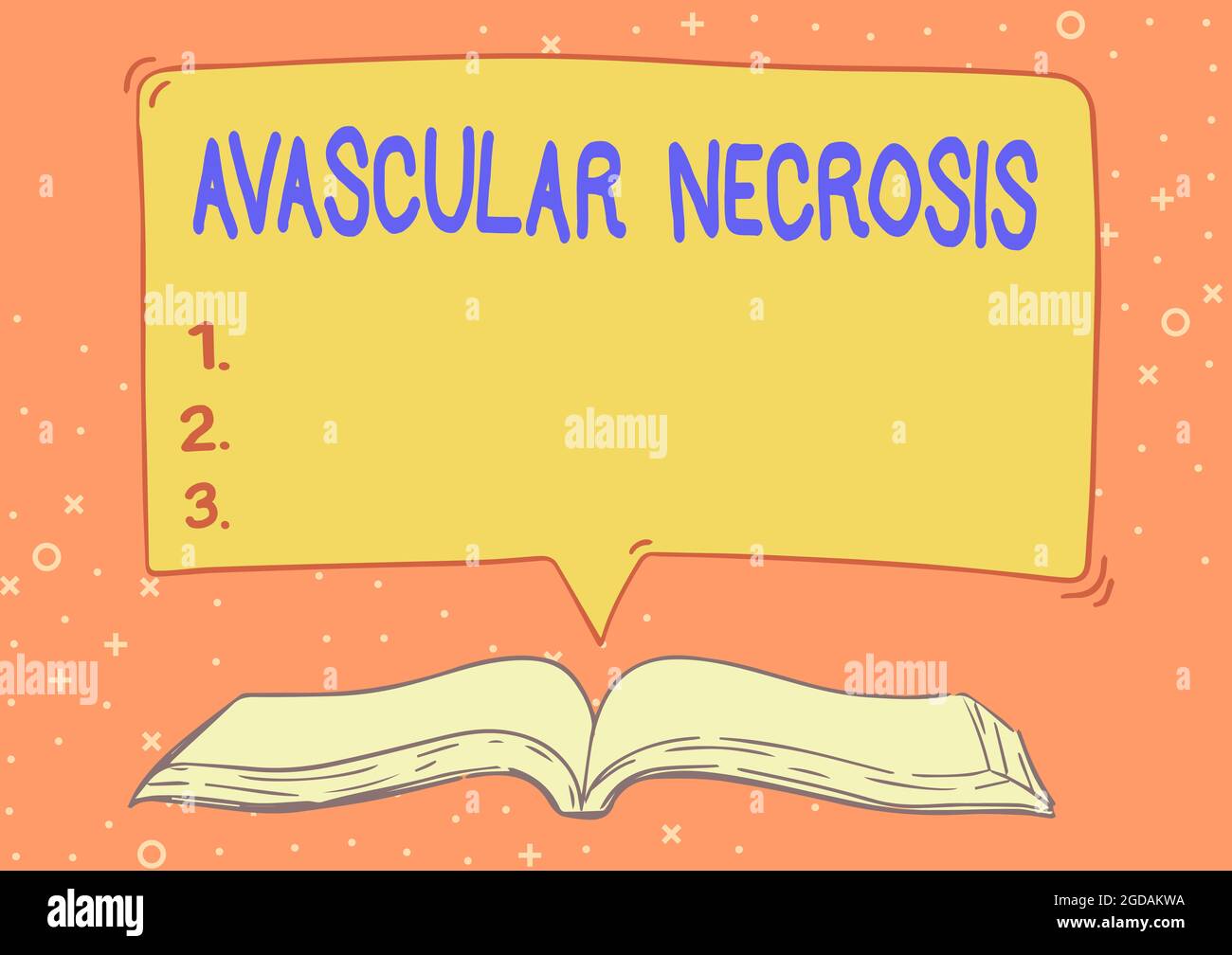Text sign showing Avascular Necrosis. Internet Concept death of bone ...