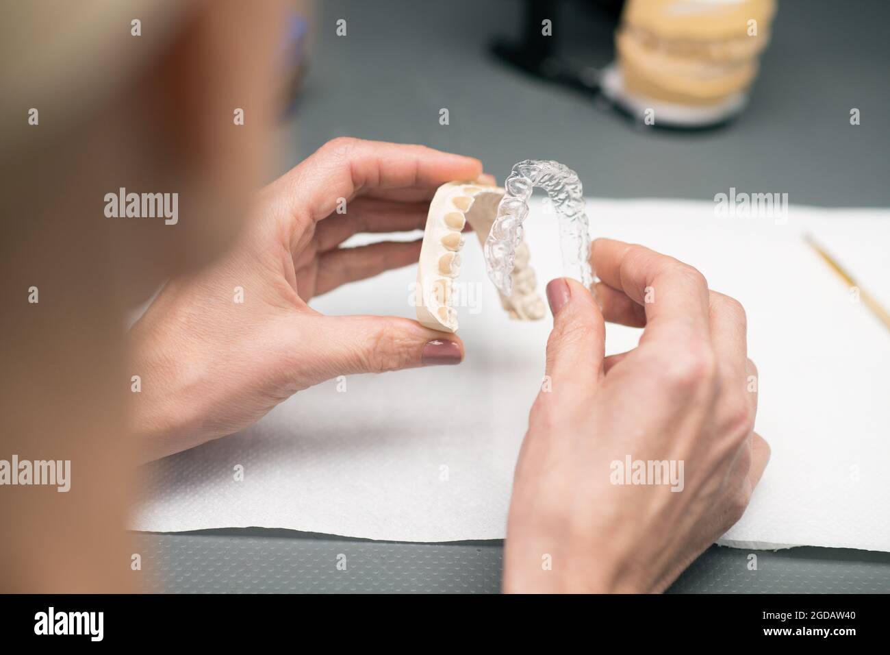Dental prothetist. Close up picture of hands with dental prosthesis ...