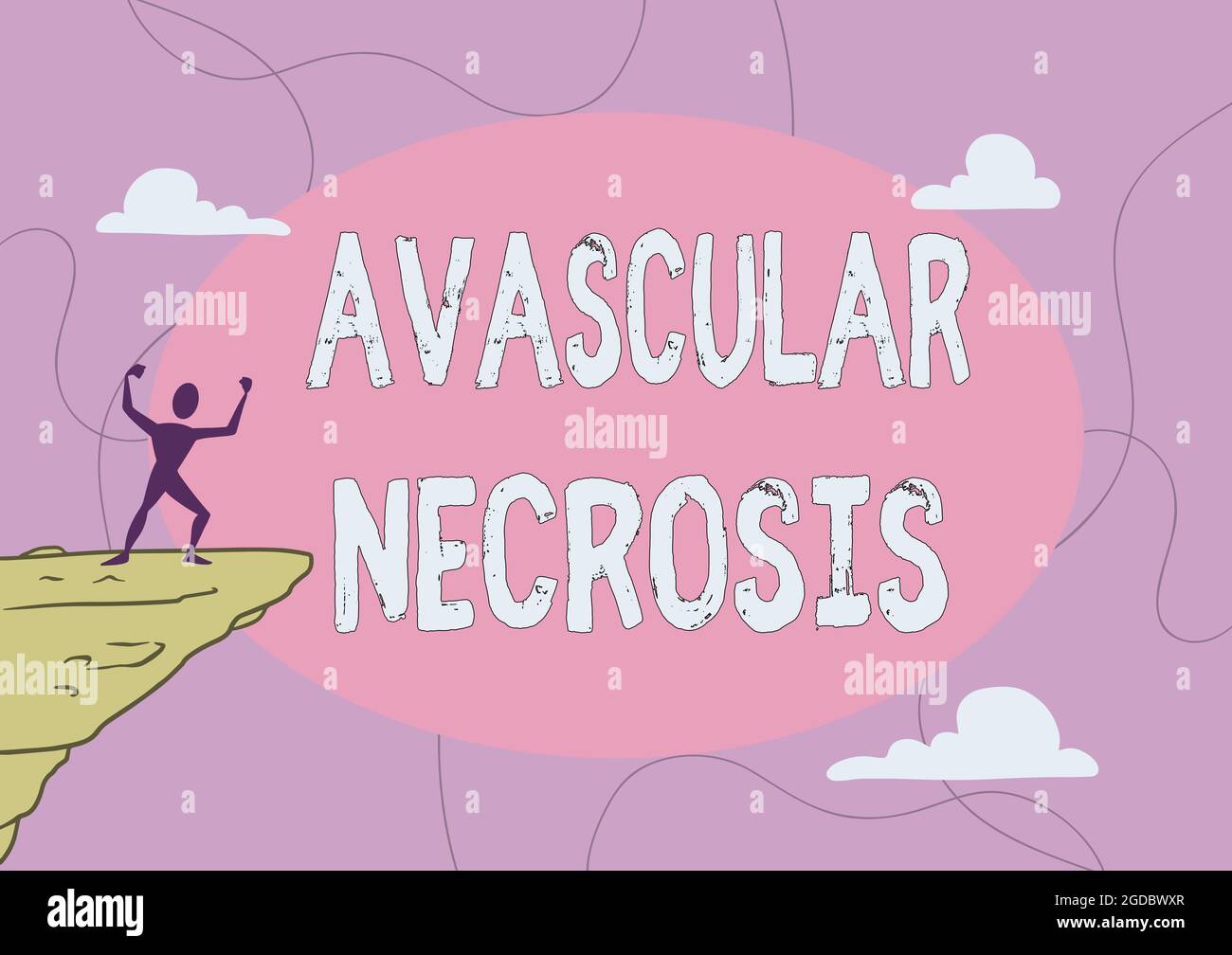 Text showing inspiration Avascular Necrosis. Business idea death of ...