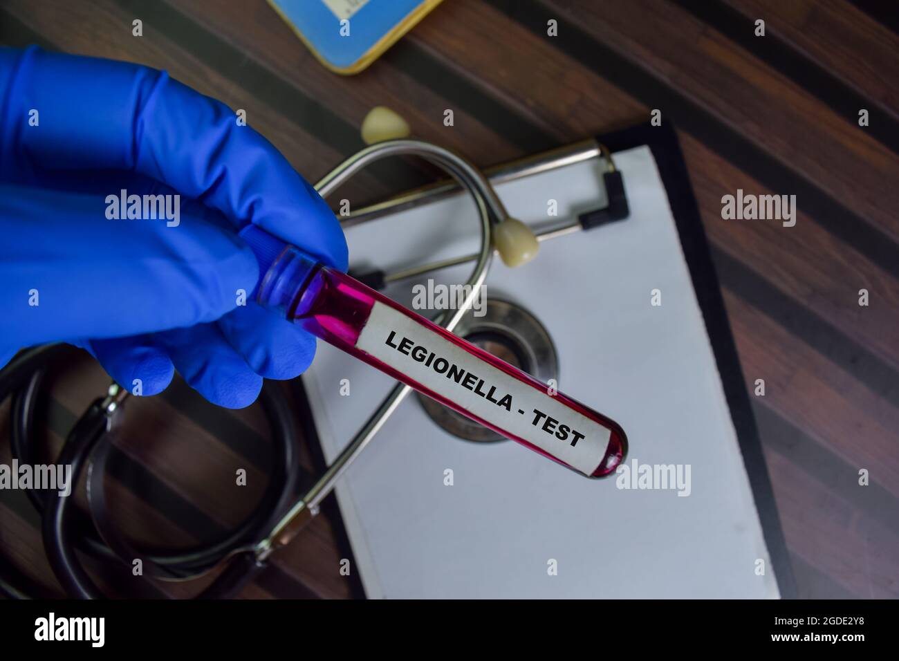 Legionella - Test with blood sample. Top view isolated on office desk ...