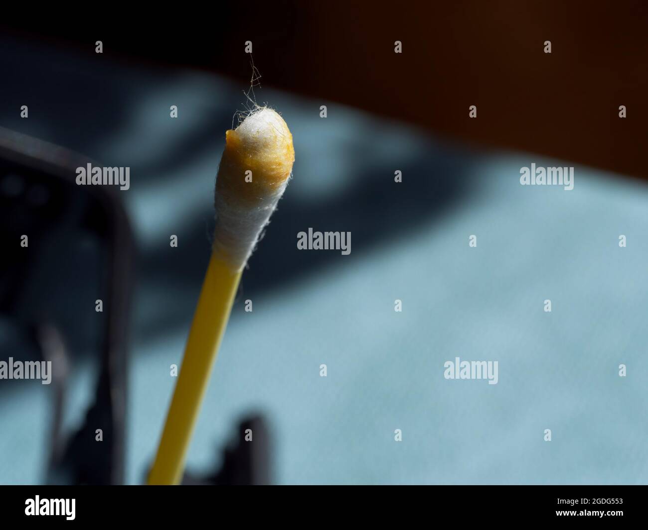 Earwax on a cotton swab, macro photo. Earwax, also known by the medical ...