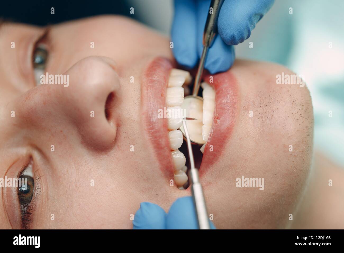 Dentistry. Dentist and patient. Dental clinic. Close up teeth Stock ...