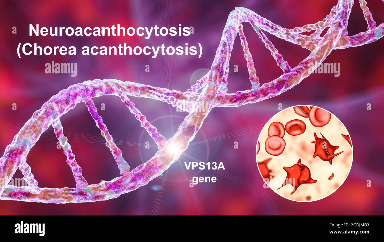 Neuroacanthocytosis, conceptual illustration Stock Photo - Alamy