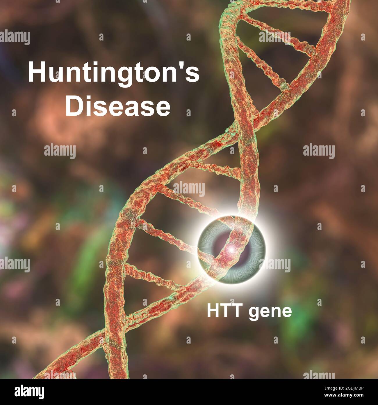 Huntington's disease, conceptual illustration Stock Photo - Alamy