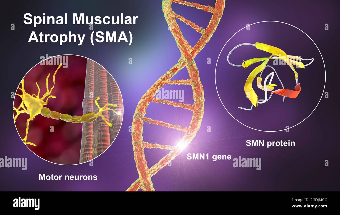 Sma type 4 hi-res stock photography and images - Alamy