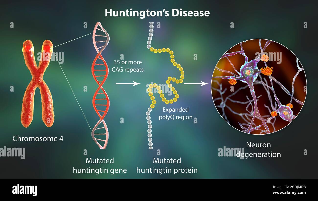 Molecular genesis of Huntington's disease, 3D illustration Stock Photo ...