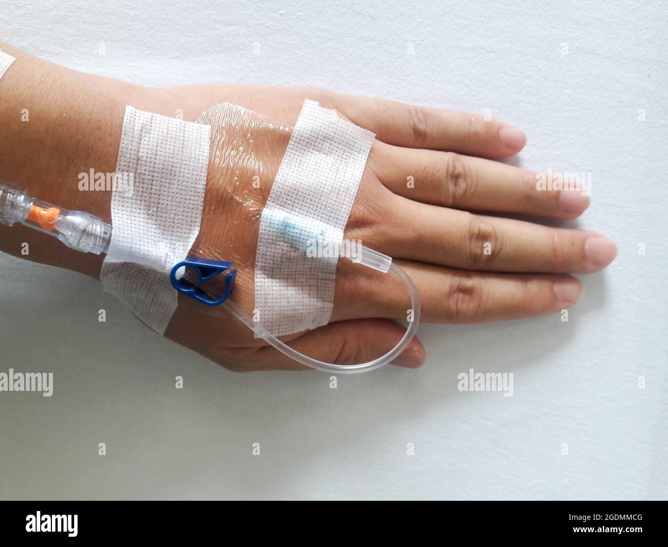 Patient hand with the tube of normal saline infusion on white cloth ...
