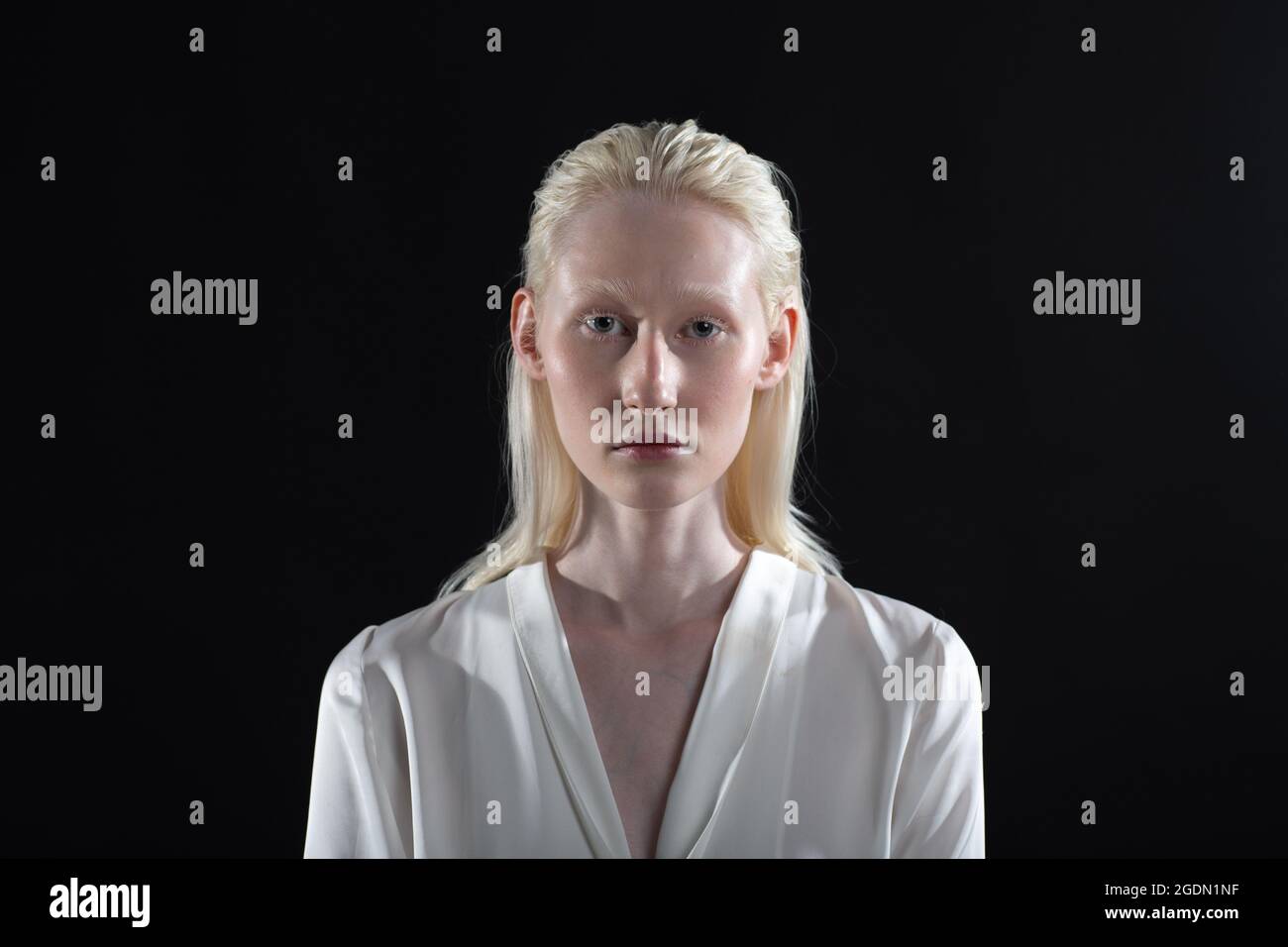 Albino girl hi-res stock photography and images - Alamy