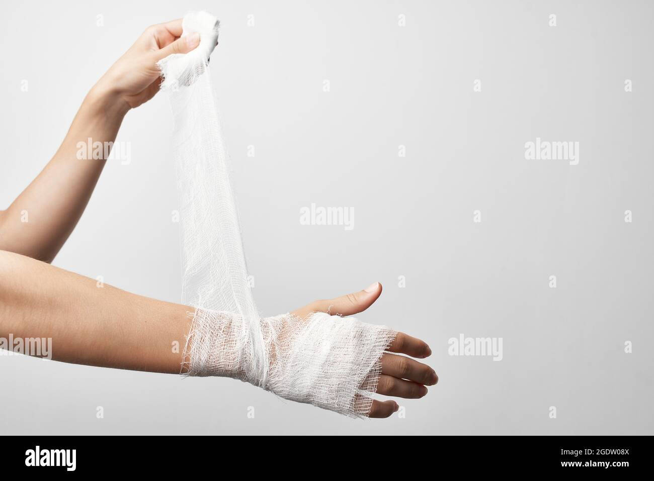 hand bandaging injury health problems treatment Stock Photo - Alamy