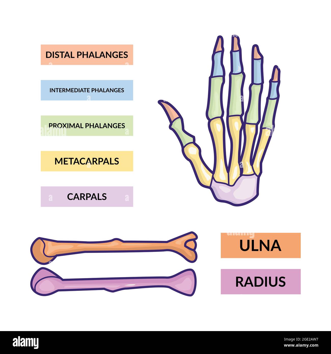 arm bone and hand bone infographic vector template Stock Vector Image ...