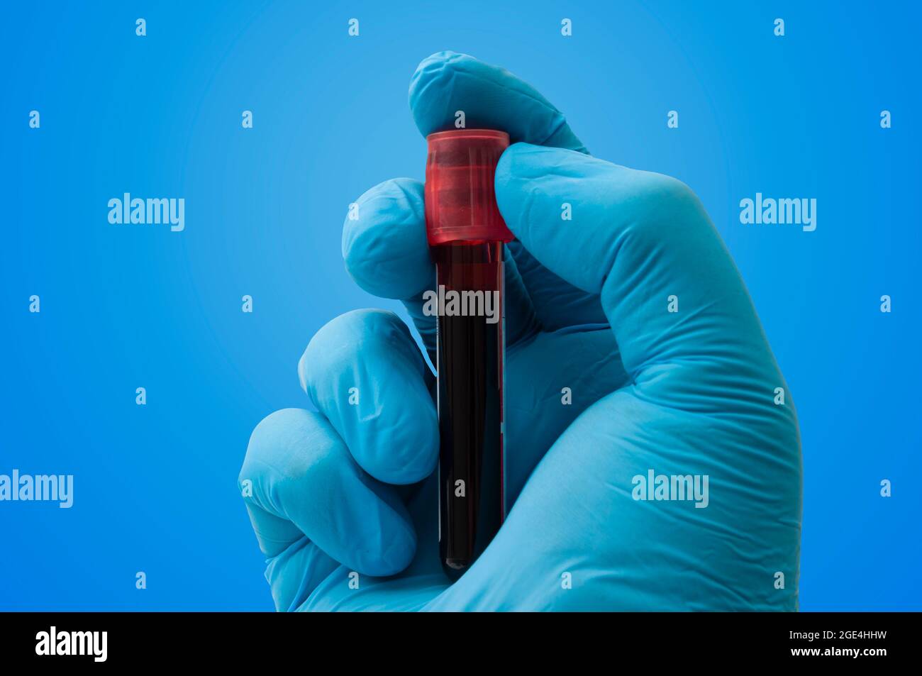 Blood Sample In Microbiology Lab at Han Schmitt blog