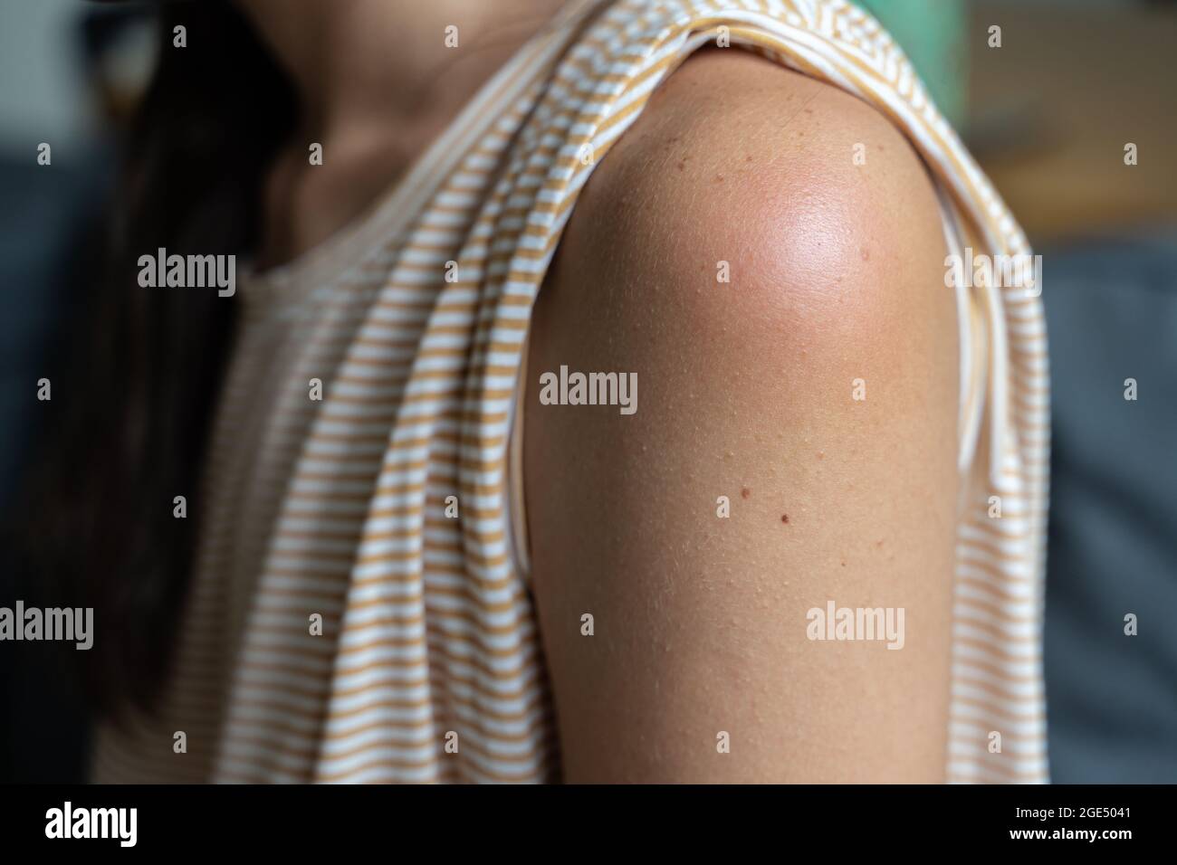 Shoulder pain after shot hi-res stock photography and images - Alamy