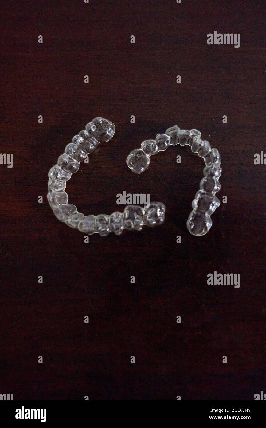 Invisible prosthesis for aligning dentures Stock Photo - Alamy