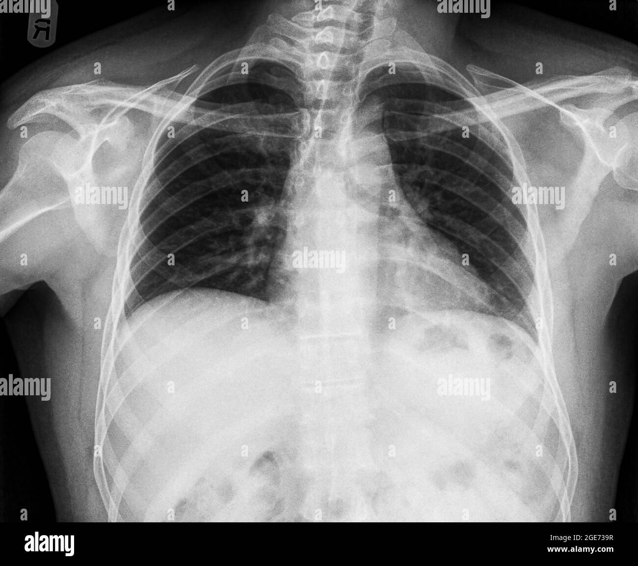 Male chest anatomy hi-res stock photography and images - Alamy