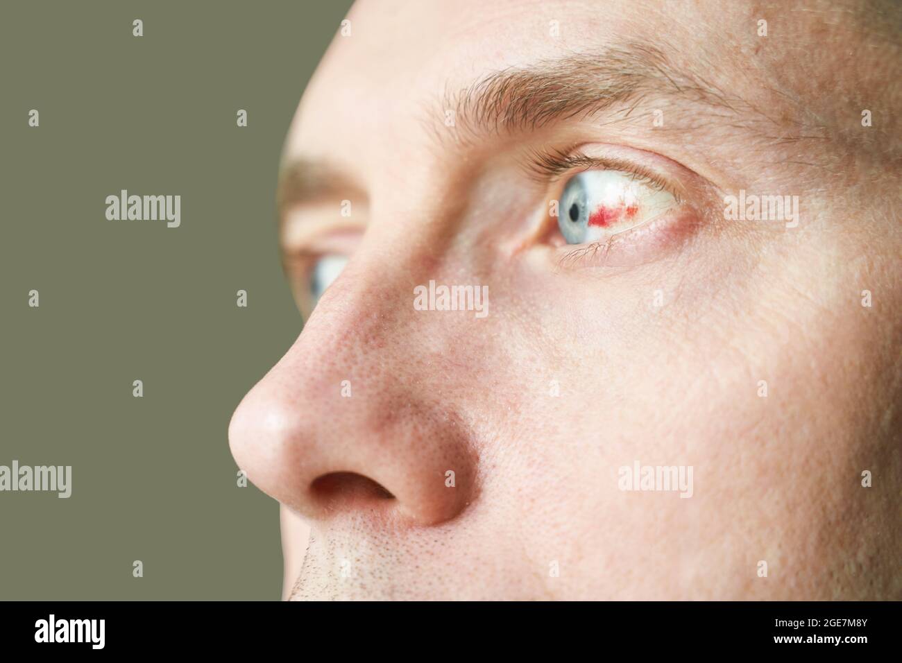 Man allergy test hi-res stock photography and images - Alamy