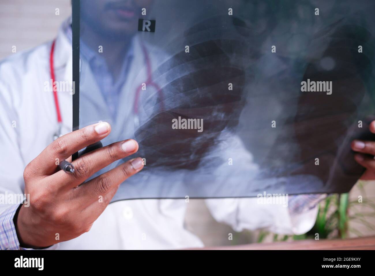 doctor hold analyzing xray photography, closeup Stock Photo - Alamy