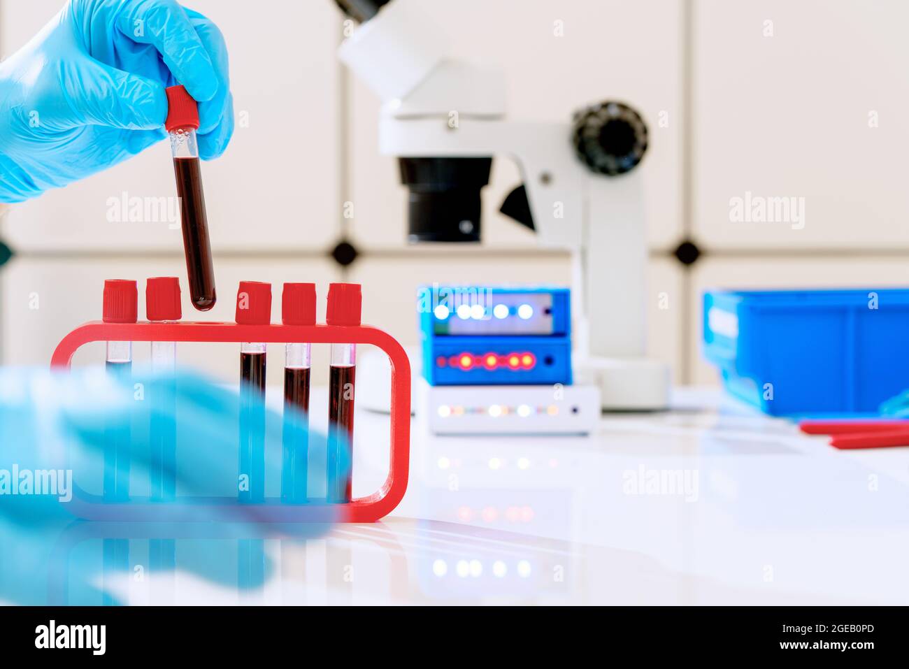 Blood test for hormones and microelements in a biochemical laboratory ...