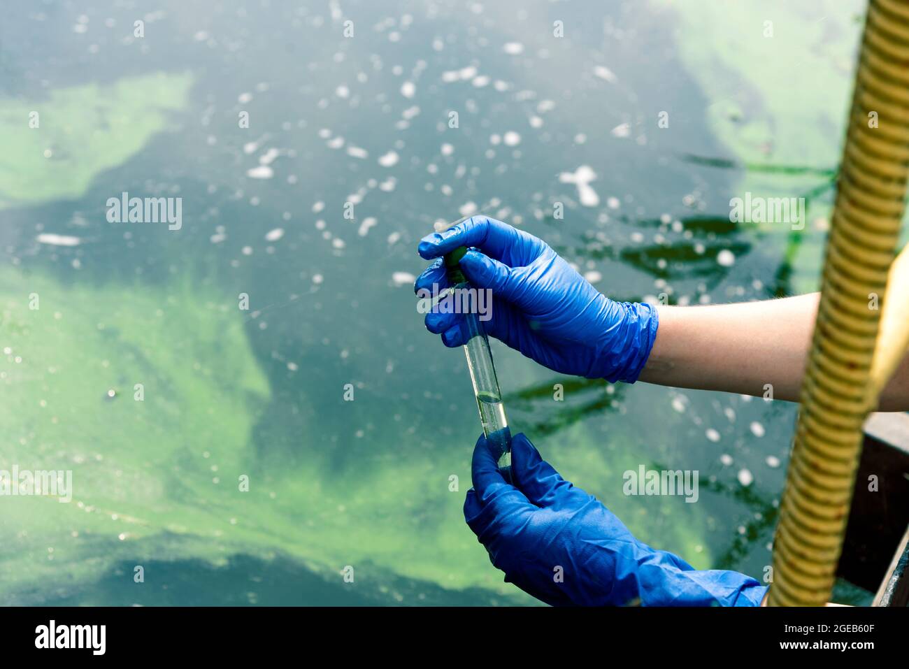 A gloved hand takes water into a test tube from a city reservoir. Urban ...