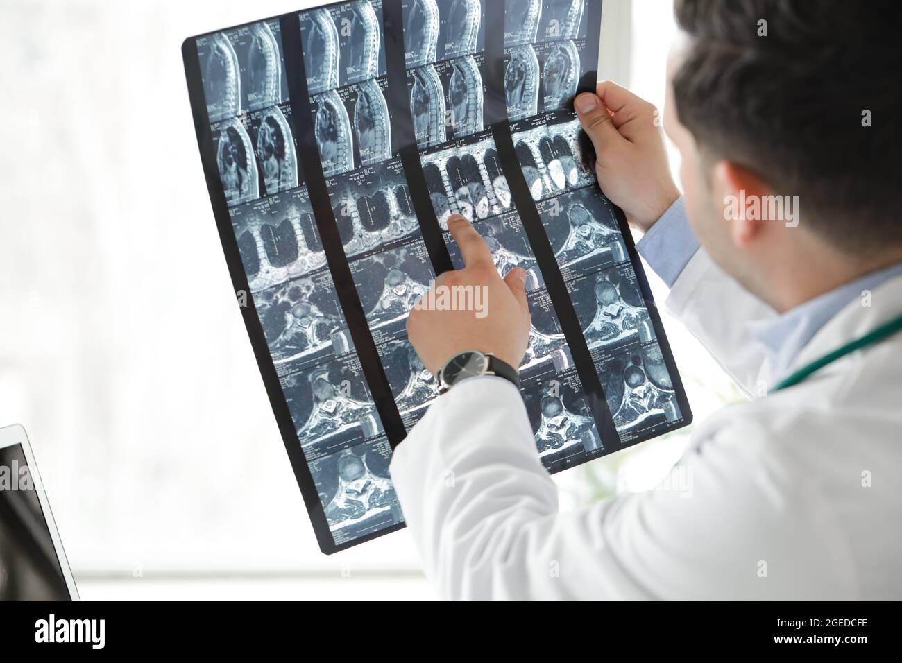 X ray spine problem hi-res stock photography and images - Alamy