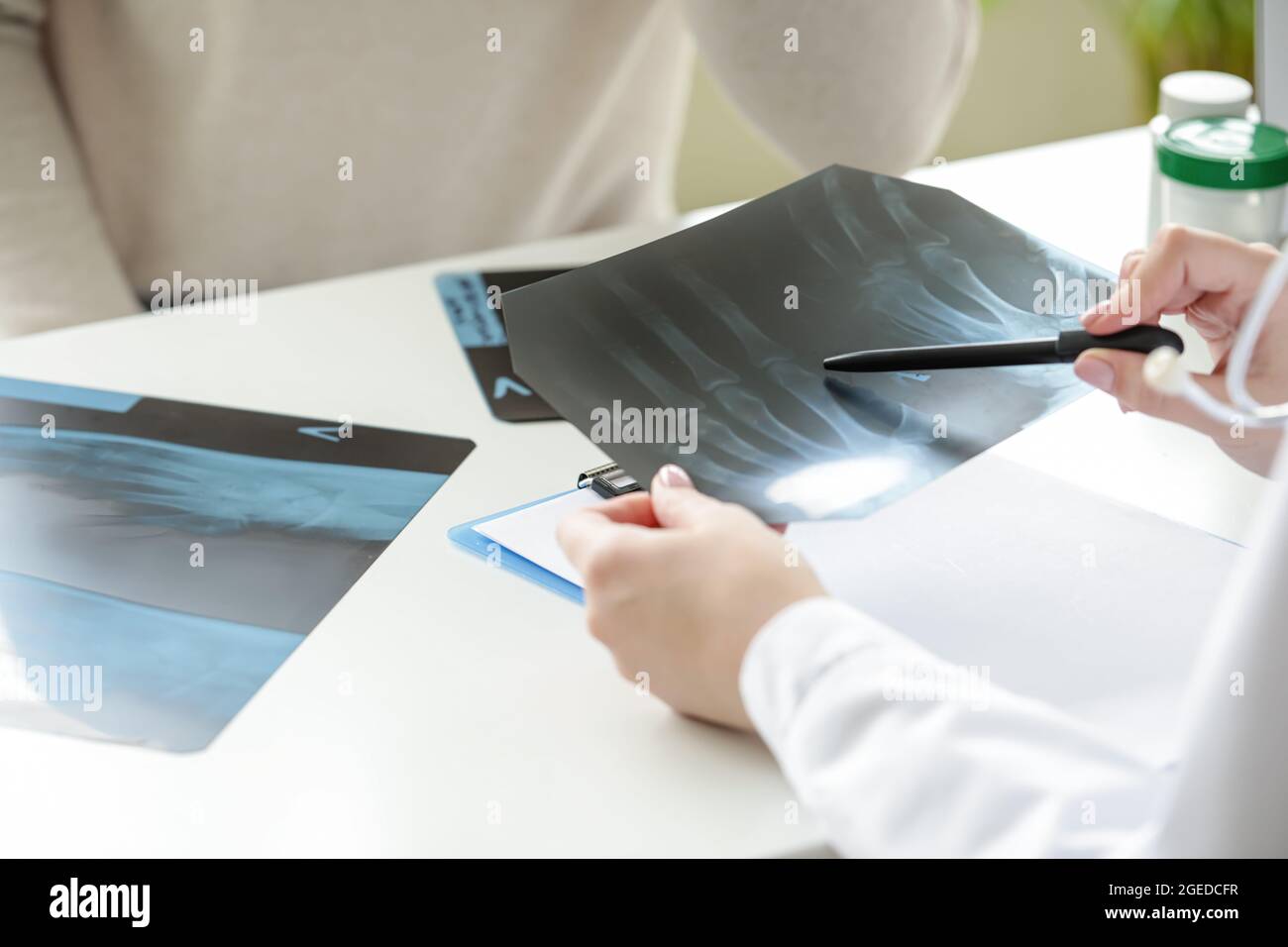 Female doctor with x-ray scan in clinic, closeup Stock Photo - Alamy