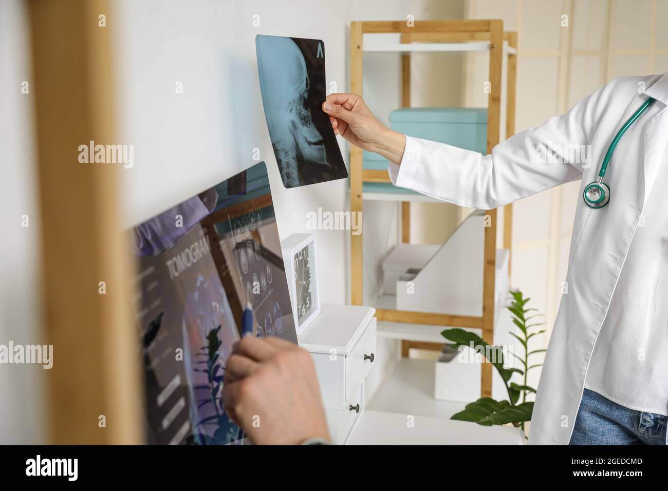 Doctors studying x-ray scans in clinic Stock Photo - Alamy