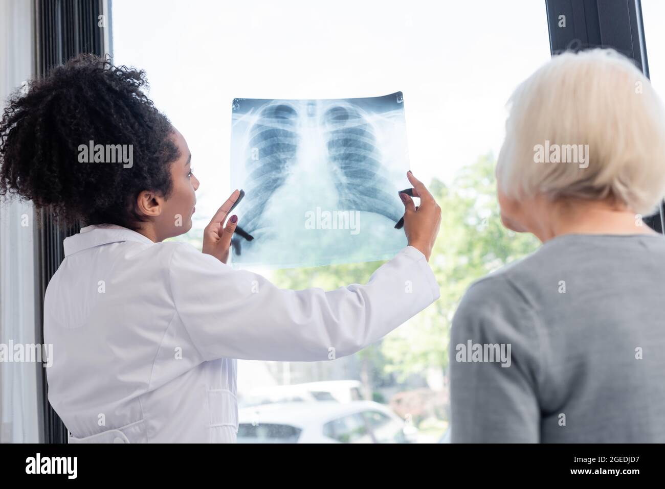 African american doctor holding fluorography near senior patient Stock ...