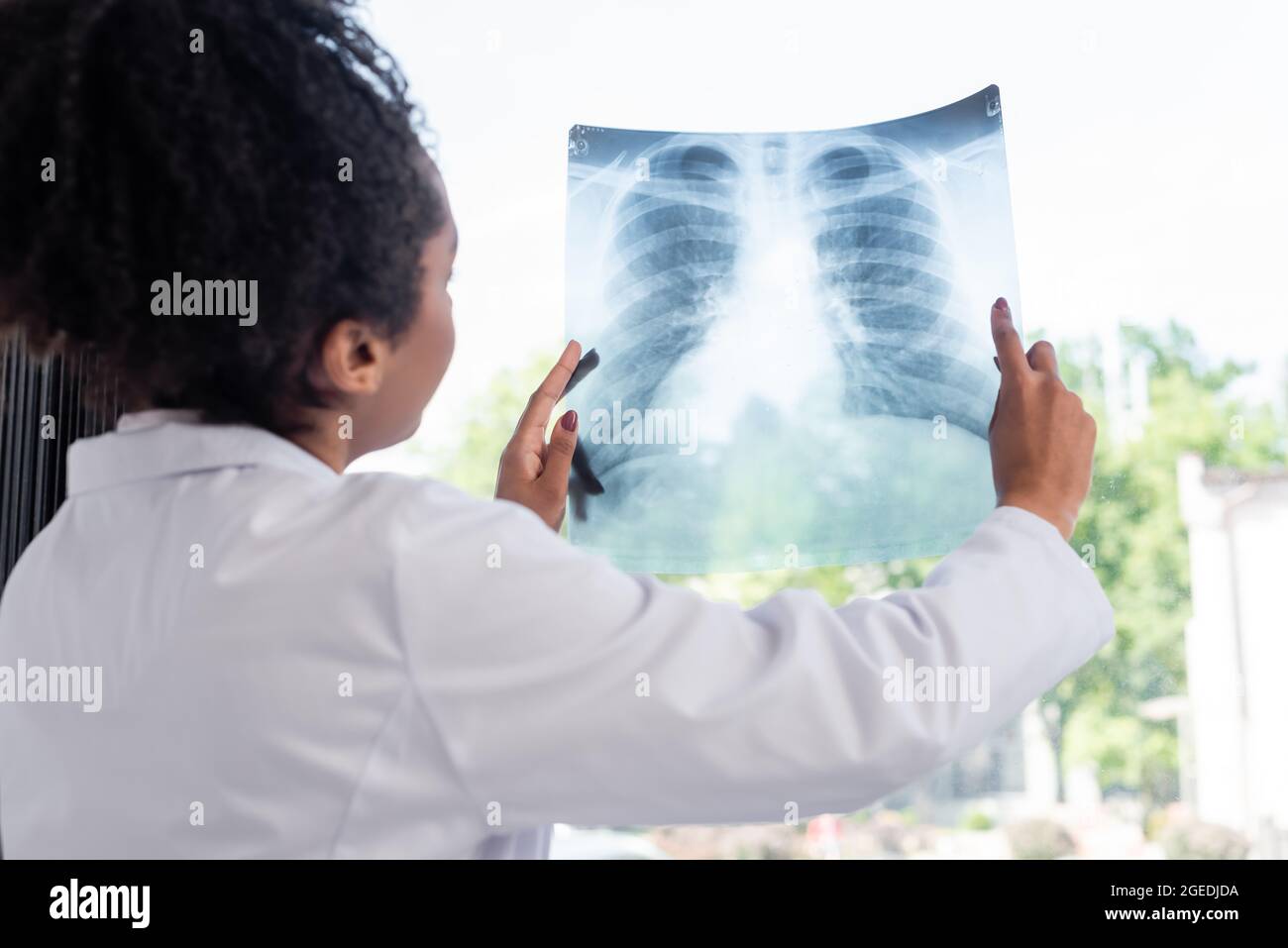 Fluorography hi-res stock photography and images - Alamy