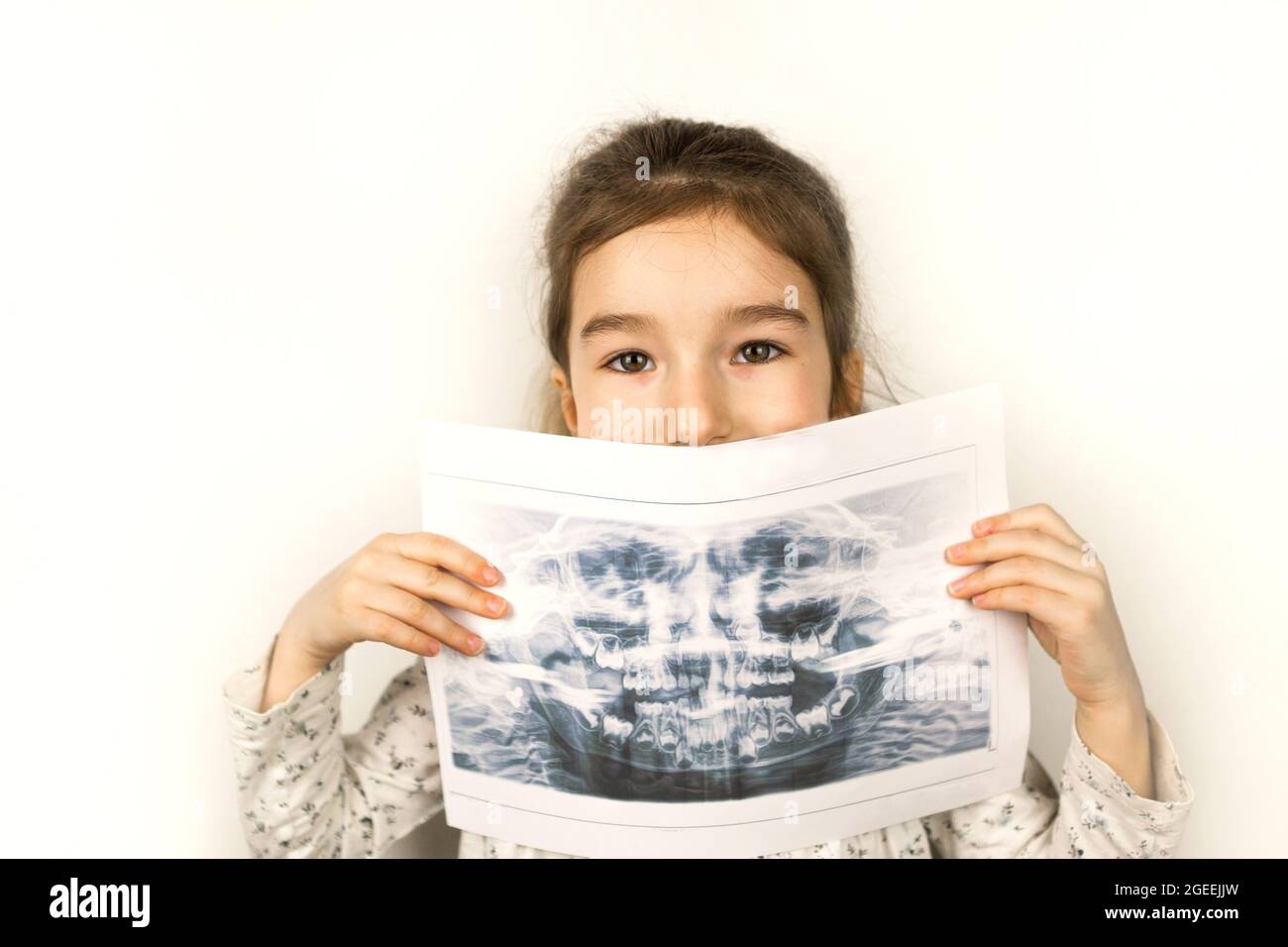 Girl holds her X-ray with a panorama of baby teeth and the second row ...